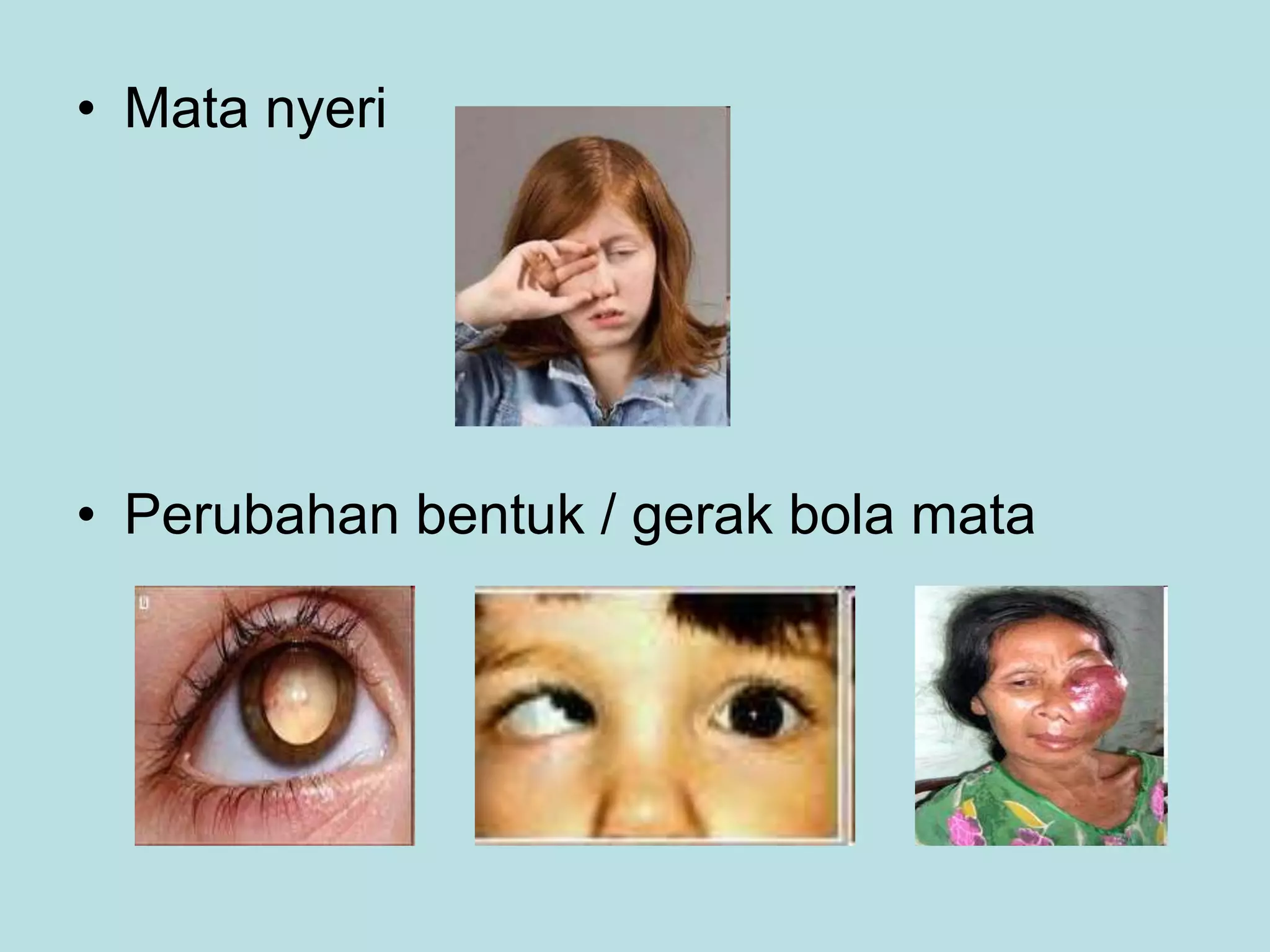 Menjaga kesehatan mata | PPTX