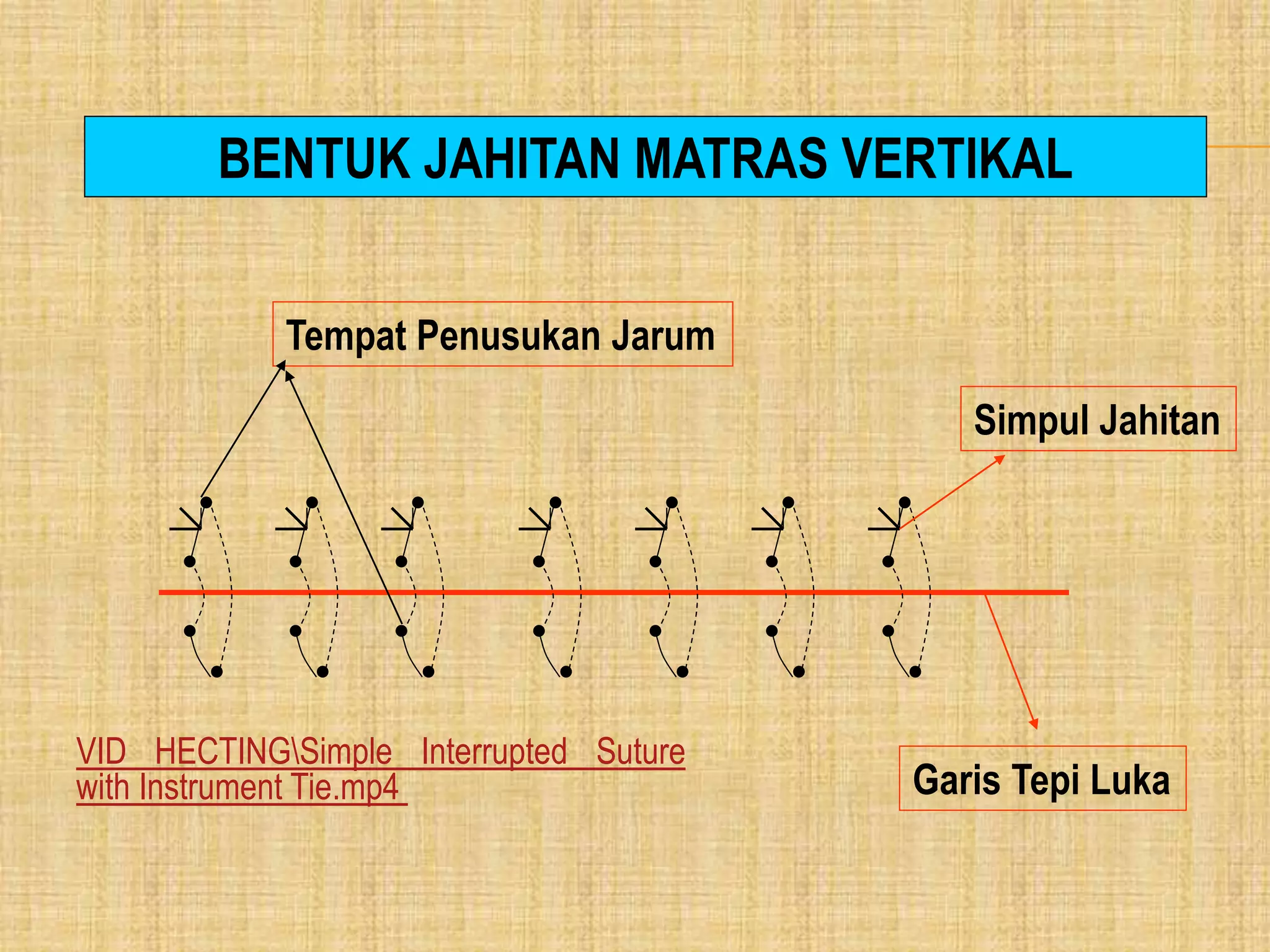 Menjahit Luka Dengan Bermacam Teknik | PPTX