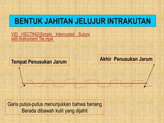 Menjahit Luka Dengan Bermacam Teknik | PPTX