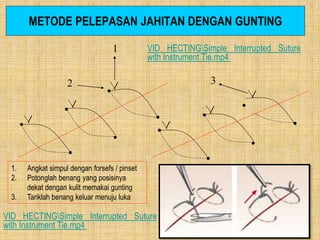 Menjahit Luka Dengan Bermacam Teknik | PPTX