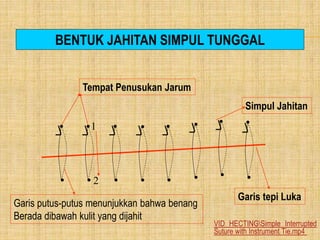Menjahit Luka Dengan Bermacam Teknik | PPTX