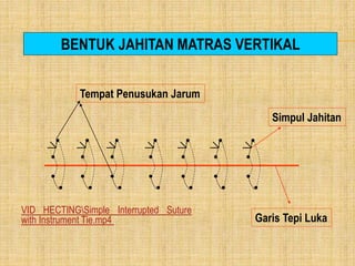 Menjahit Luka Dengan Bermacam Teknik | PPTX