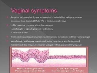 menopause part 1.pptx