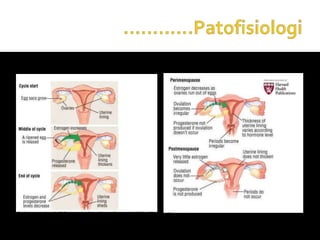 Menopause ppt | PPTX