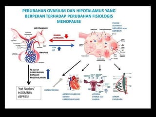 Menopause ppt | PPTX
