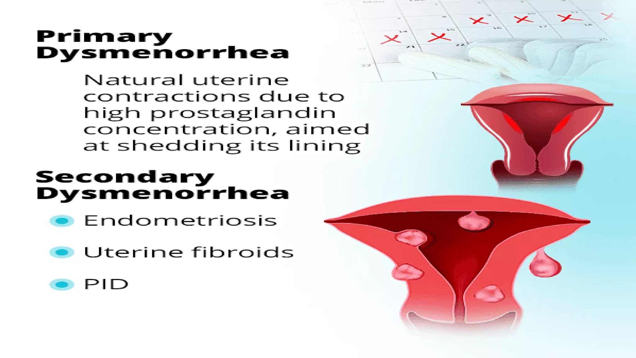 Types of Menstrual disorders and there causes and symptoms | PDF