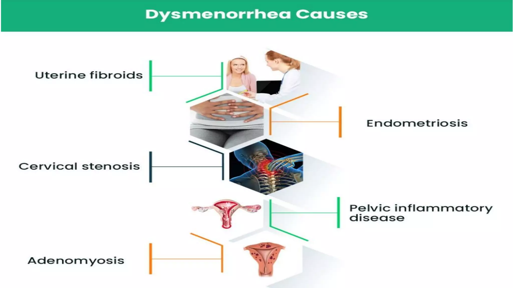 Types of Menstrual disorders and there causes and symptoms | PDF