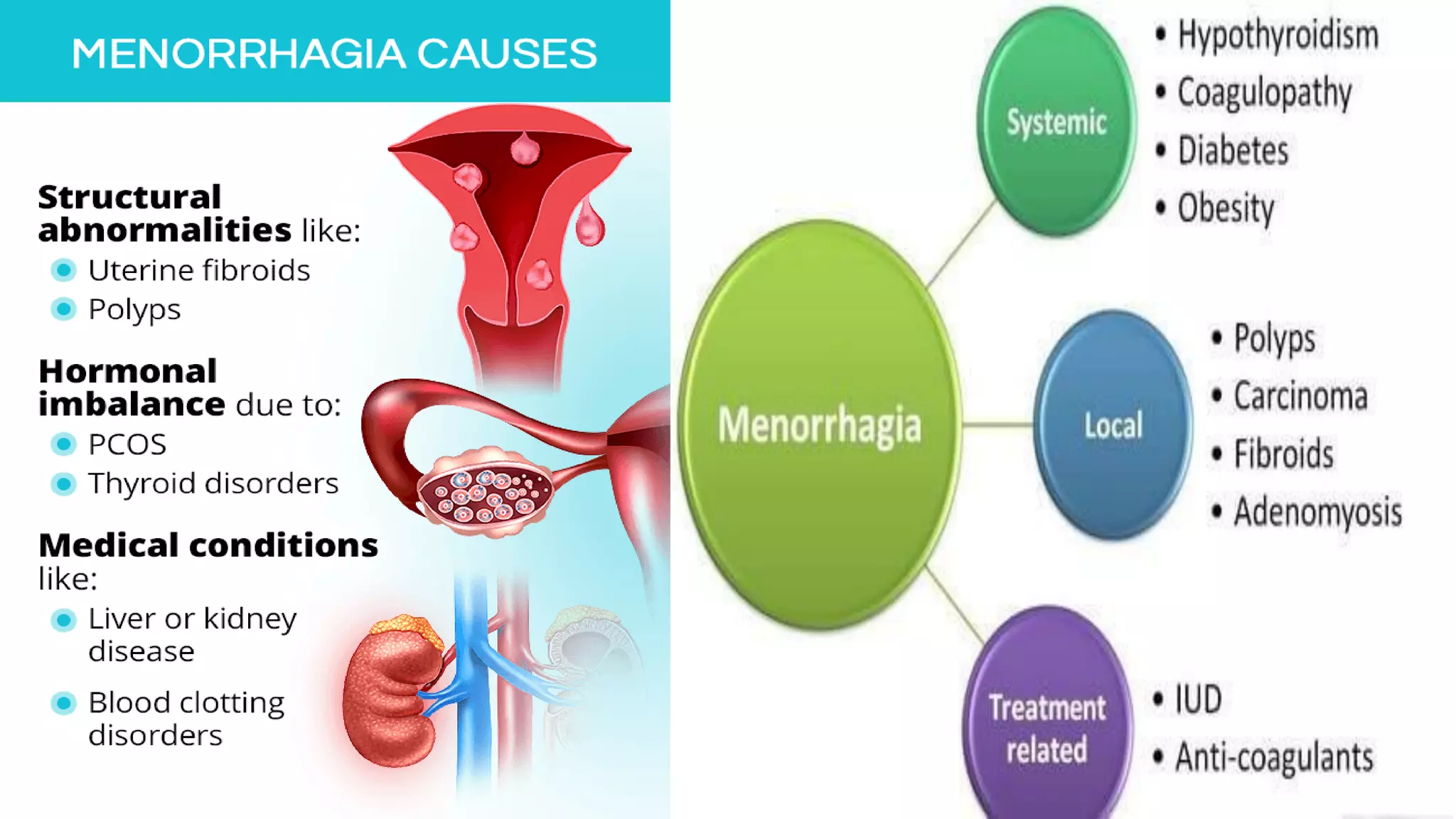 Types of Menstrual disorders and there causes and symptoms | PDF