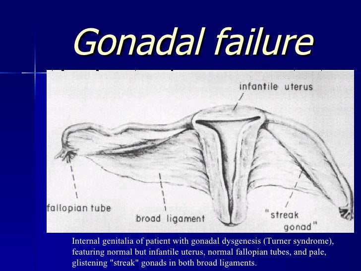 Menstrual dysfunction