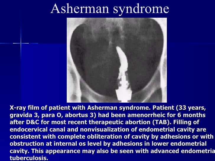 Menstrual dysfunction