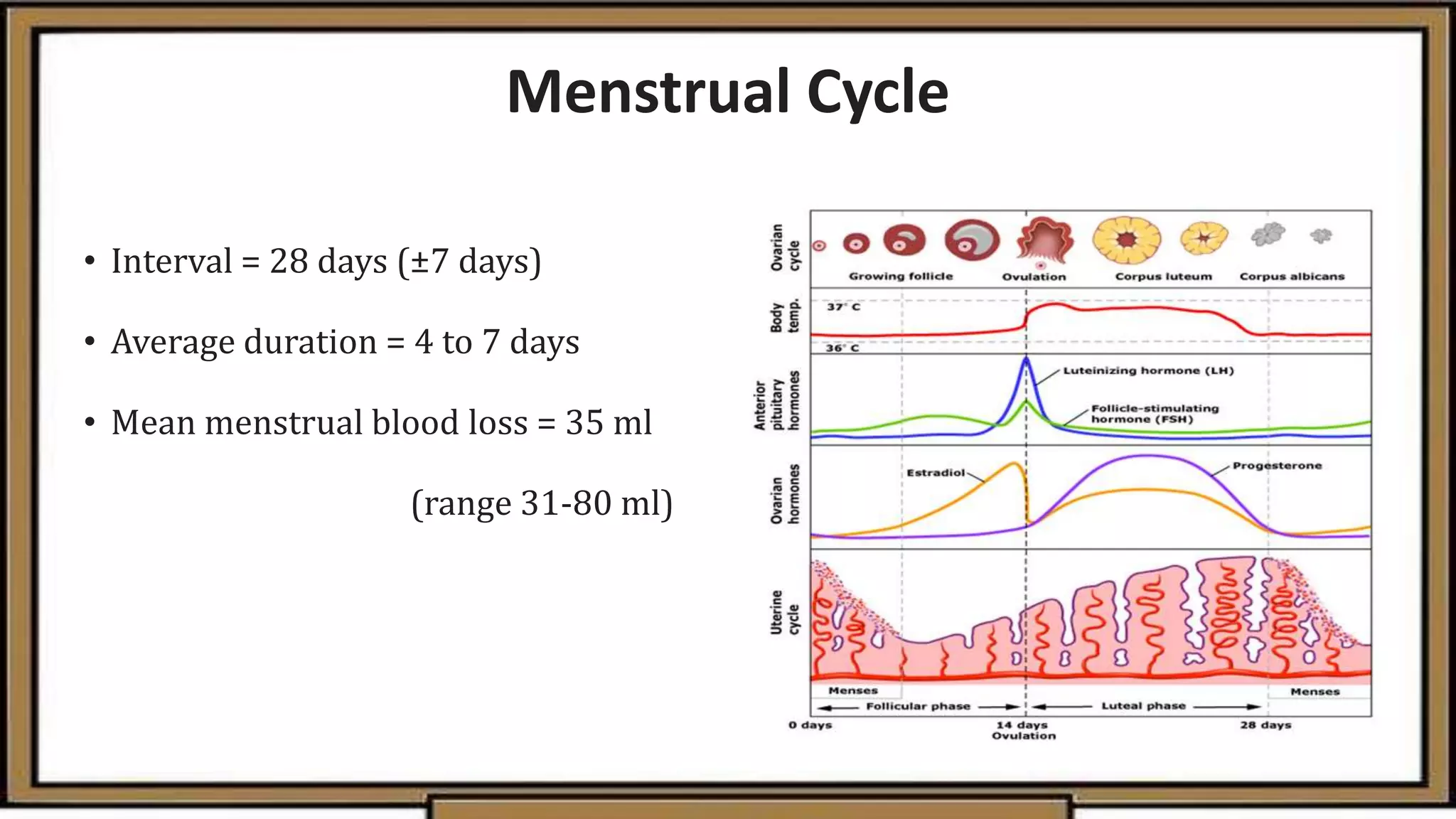 Menstrual irregularities - Menorrhagia | PPTX