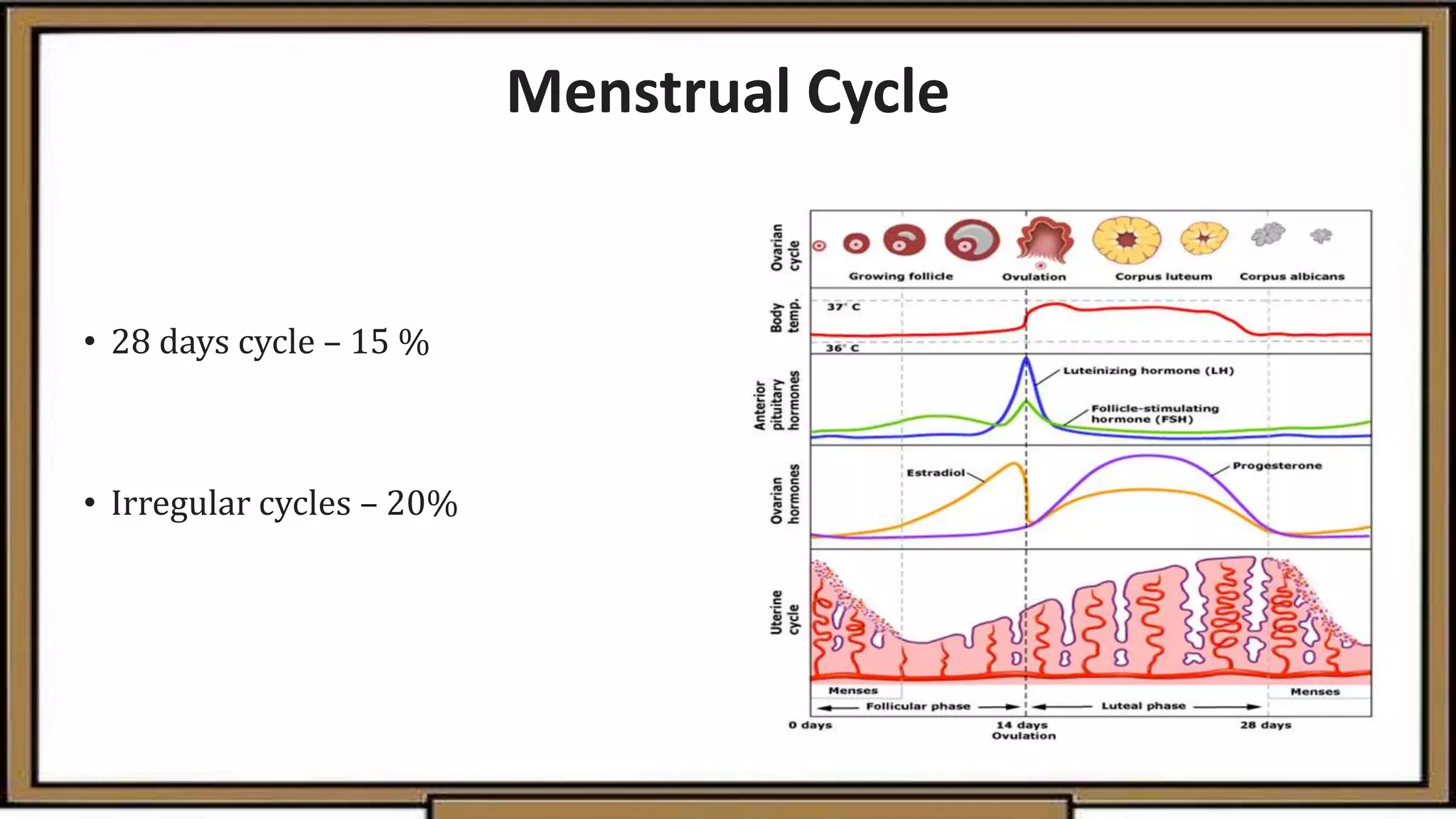 Menstrual irregularities - Menorrhagia | PPTX