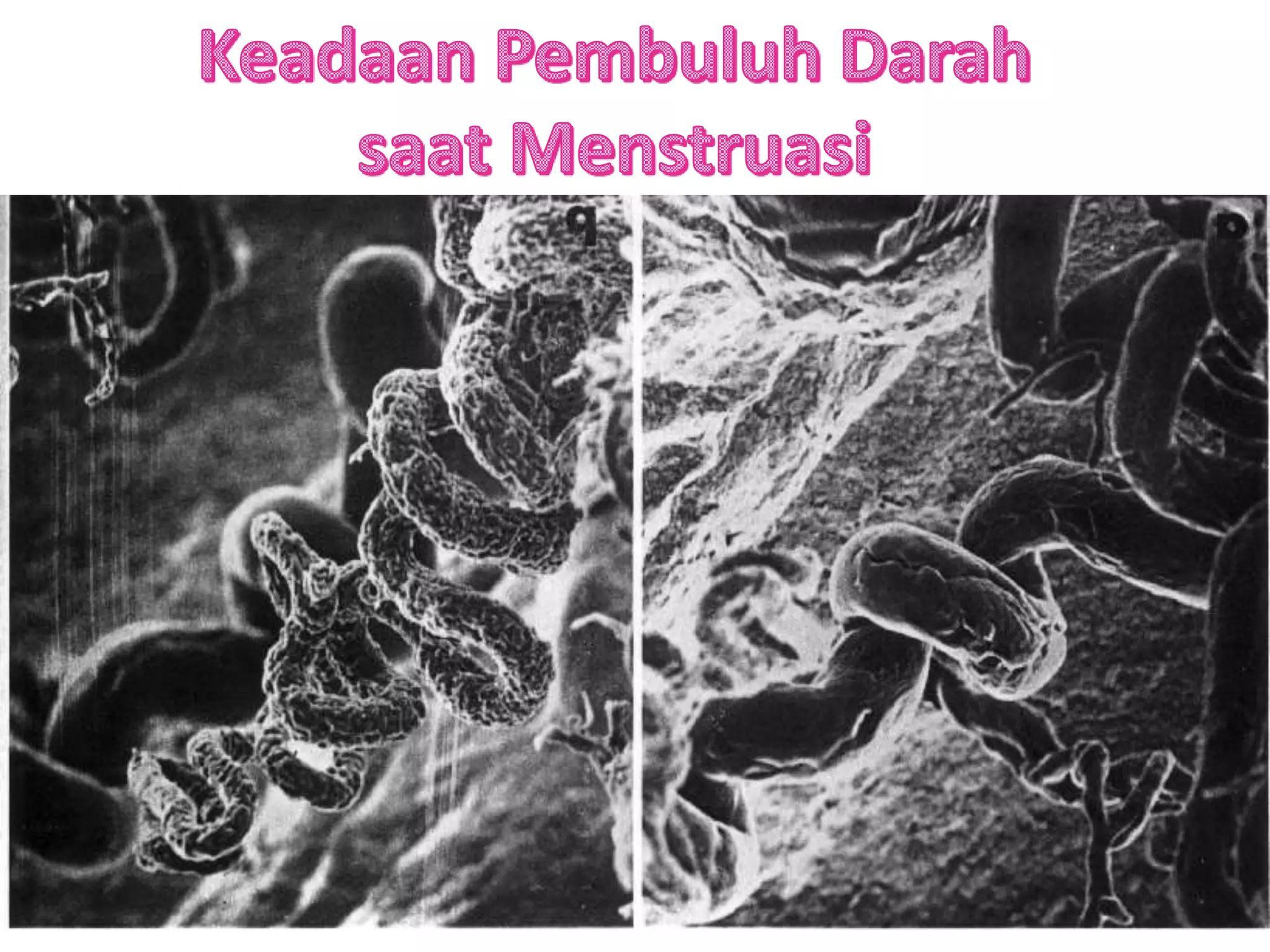 Menstruasi (Siklus Menstruasi dan Gangguannya) | PPTX