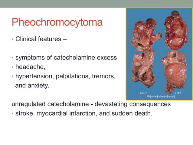 men syndrome. ppt genomic and genetics | PPT
