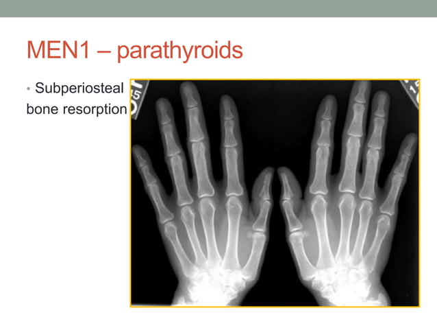 Men syndromes | PPTX