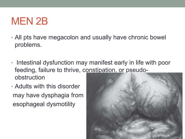 Men syndromes | PPT