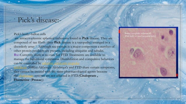 Mental disorders of presenile and senile age | PPT