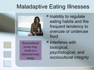 Mental health eating disorders | PPT