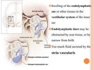 Menyer kasalligi etiologiyasi, patogenezi, klinikasi | PPTX