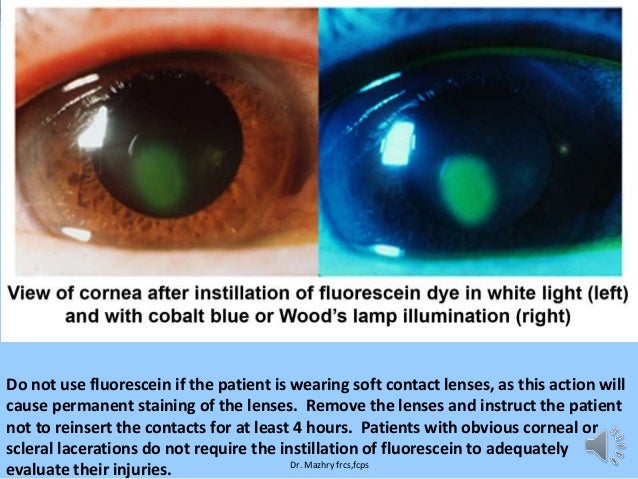 Undergraduate lecture 5-General Ophthalmic Evaluation and Management