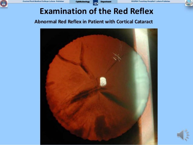 Undergraduate lecture 5-General Ophthalmic Evaluation and Management