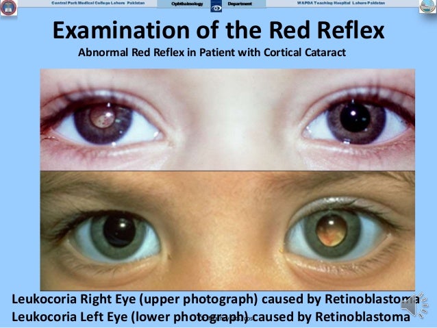 Undergraduate lecture 5-General Ophthalmic Evaluation and Management