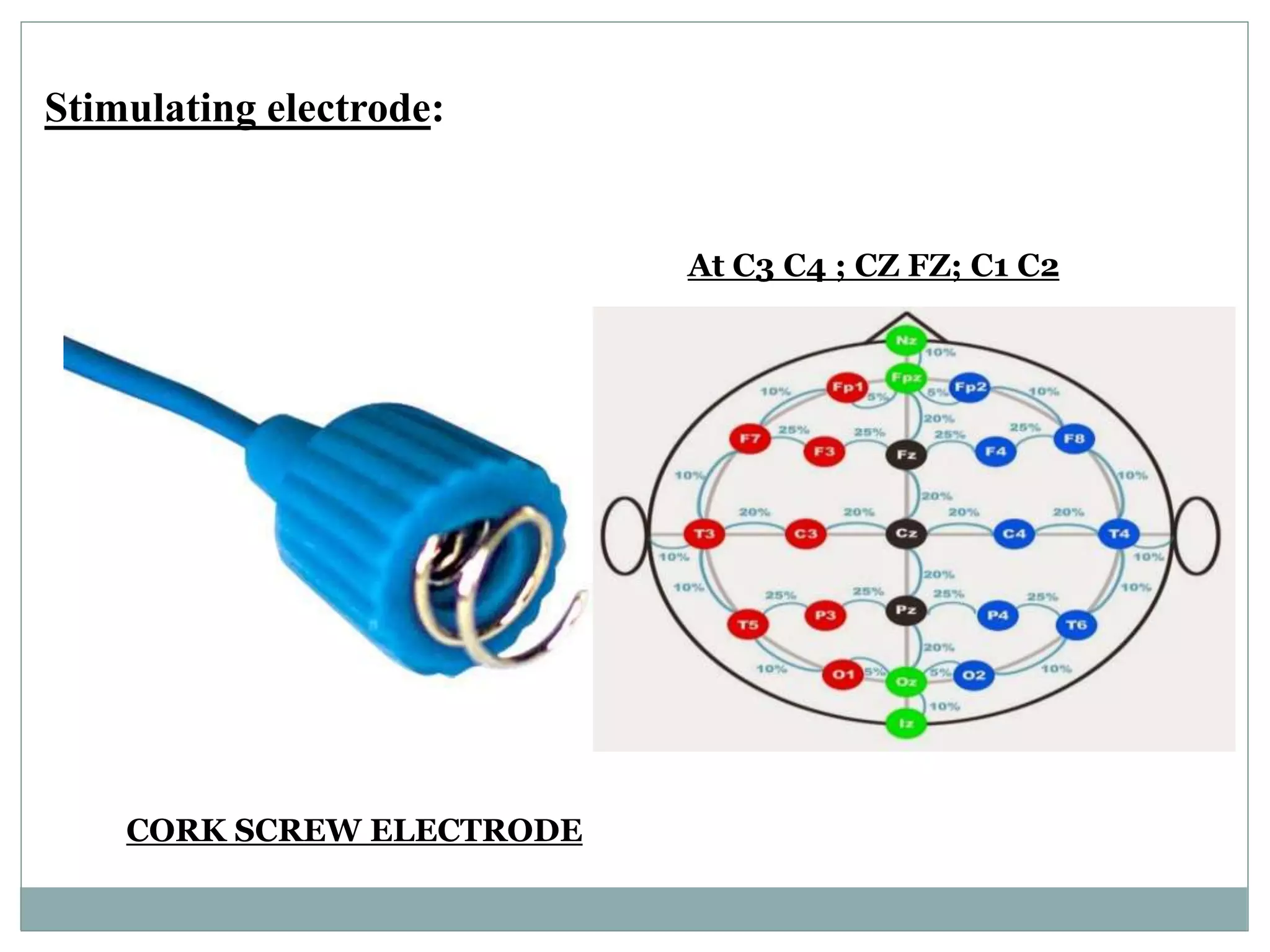 Motor evoked potentials - IONM Basics | PPTX