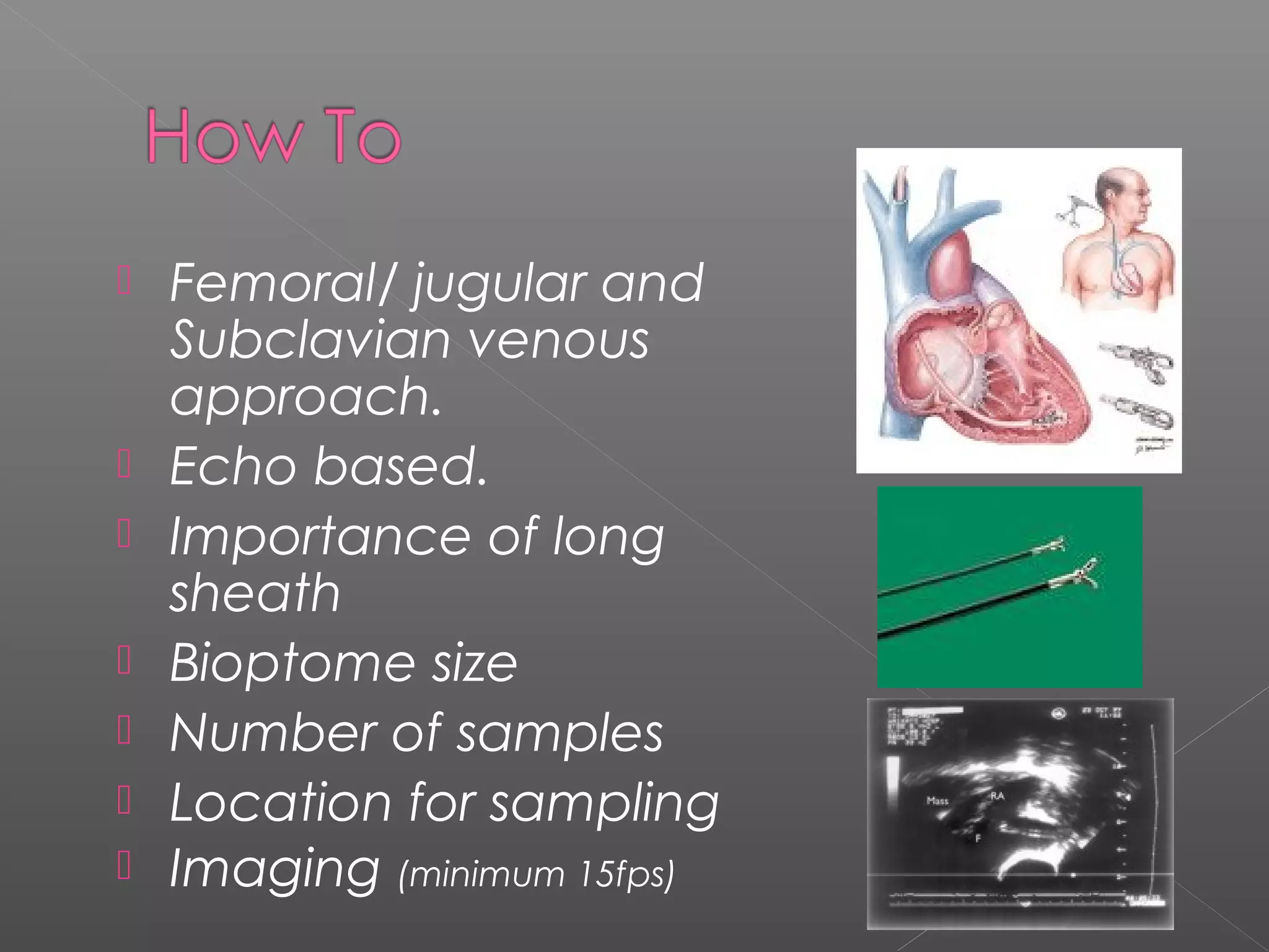 Endomyocardial Biopsy | PPT