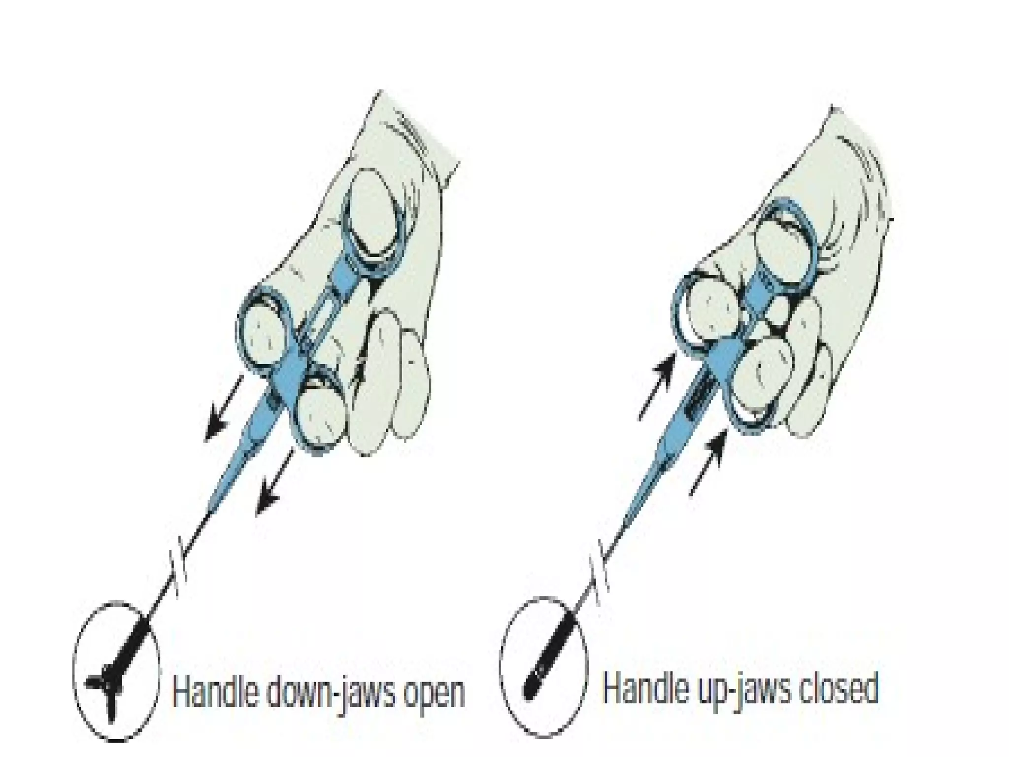 Endomyocardial Biopsy | PPT