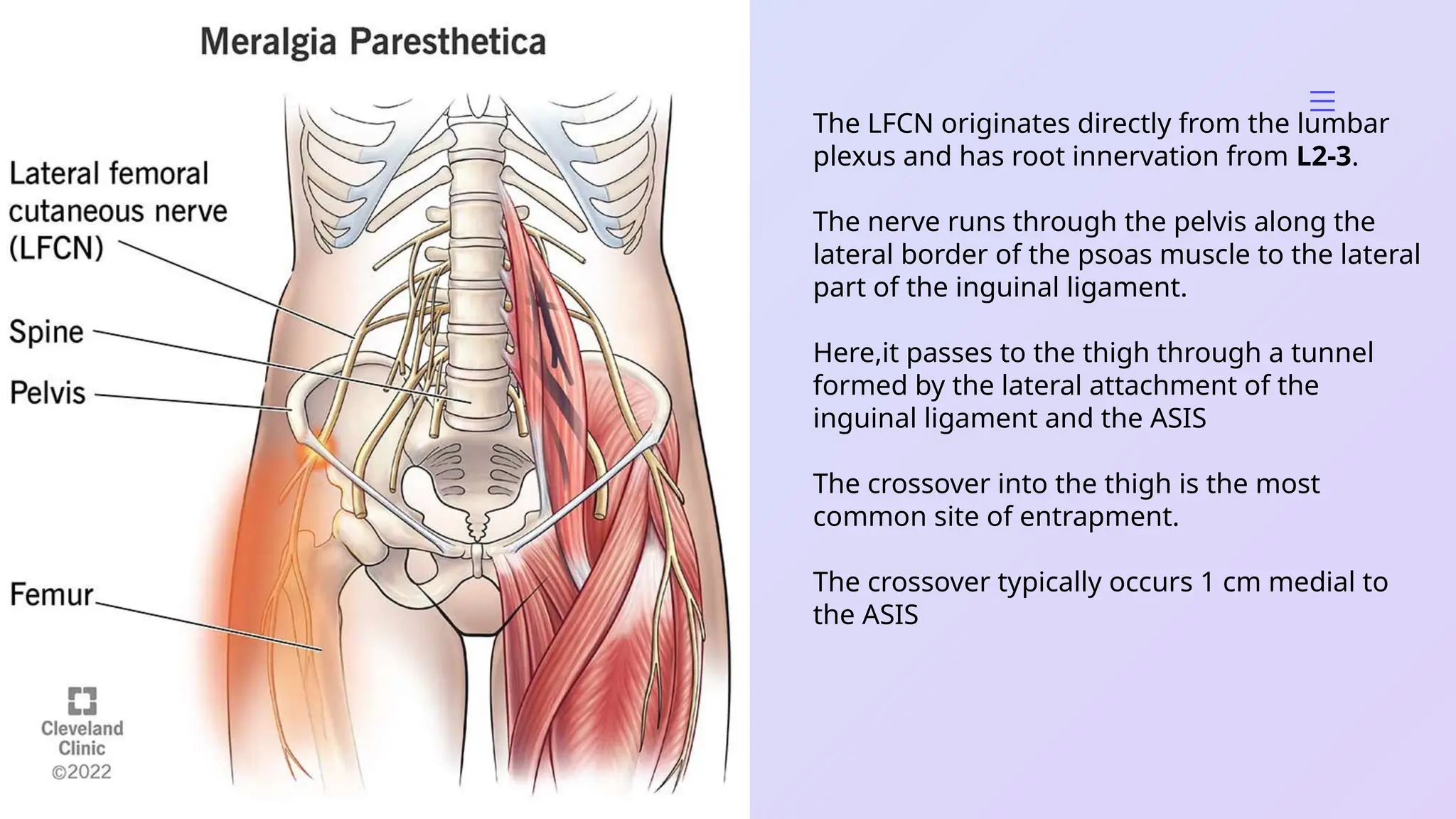 All about Meralgia Paresthetica .pptx
