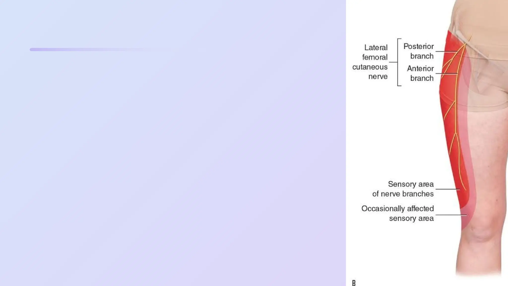 All about Meralgia Paresthetica .pptx