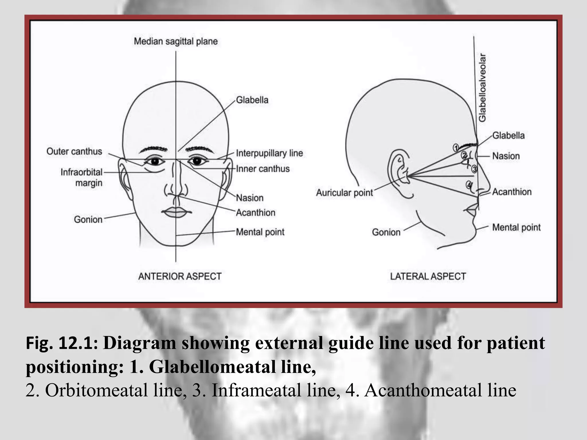 landmarks and interpretation in extraoral radiography | PPTX