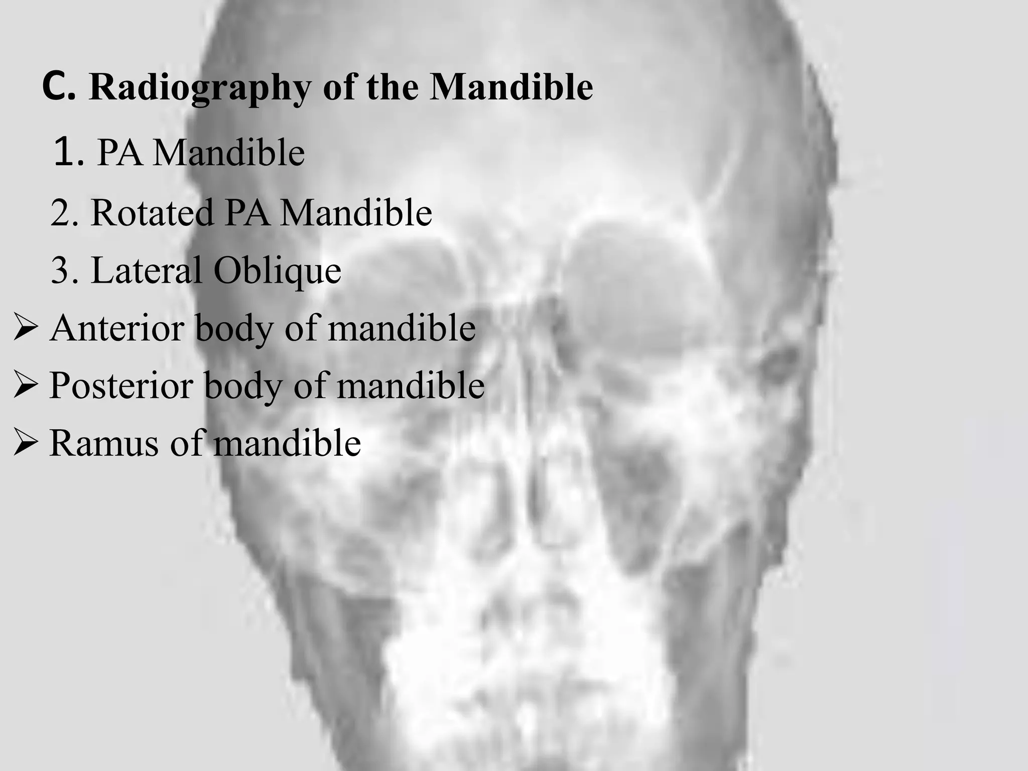 landmarks and interpretation in extraoral radiography | PPTX