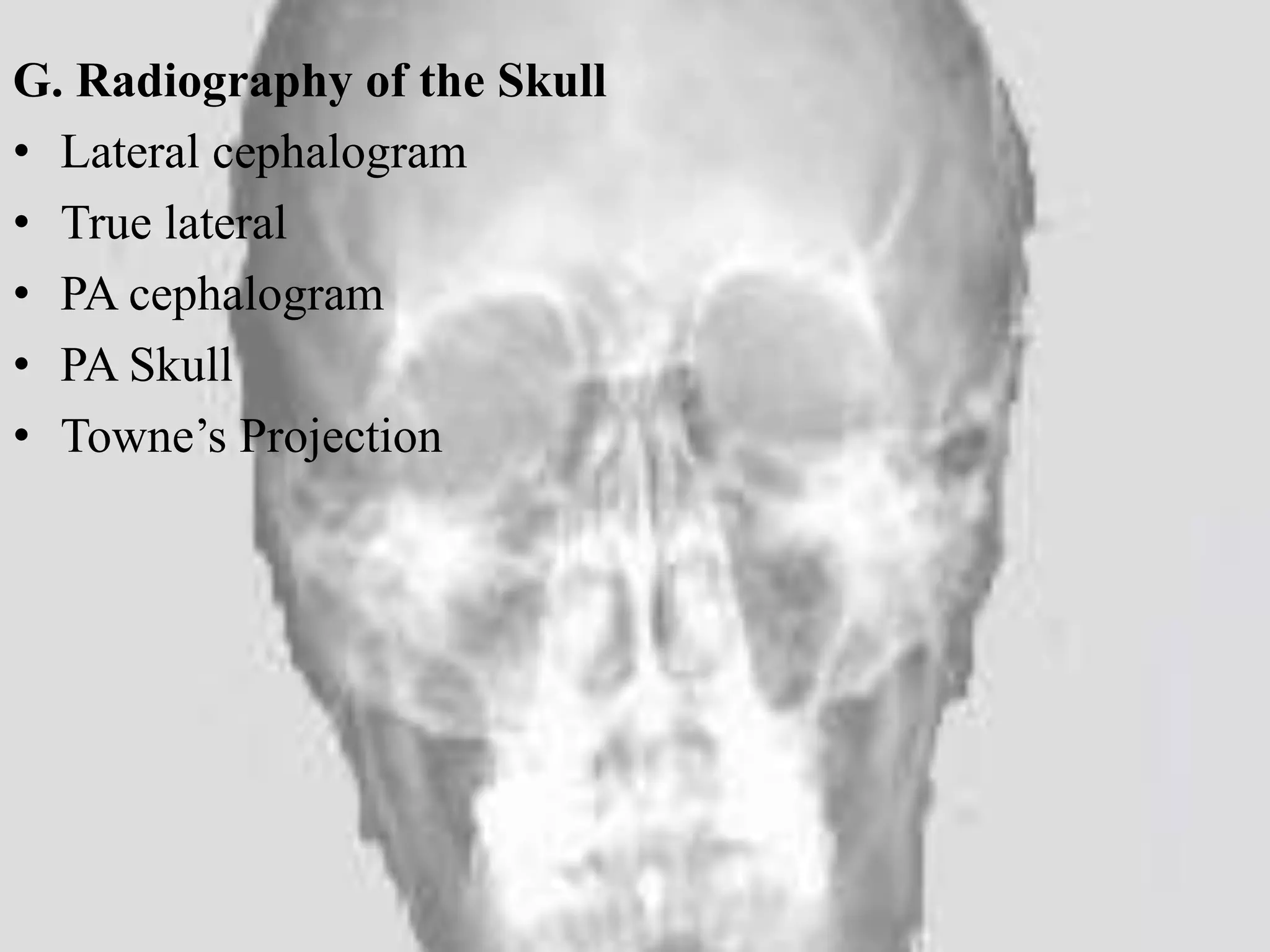 landmarks and interpretation in extraoral radiography | PPTX