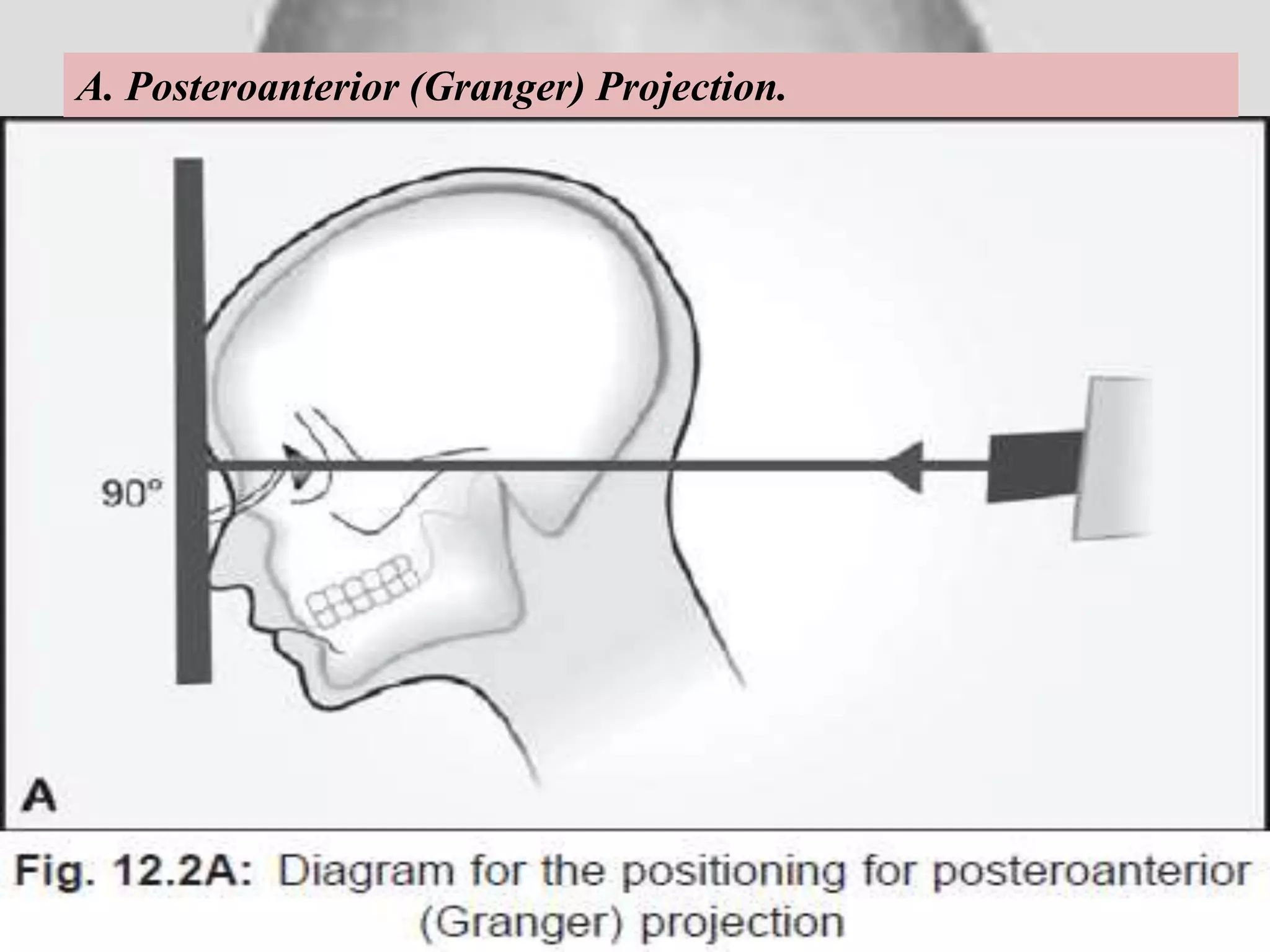 landmarks and interpretation in extraoral radiography | PPTX