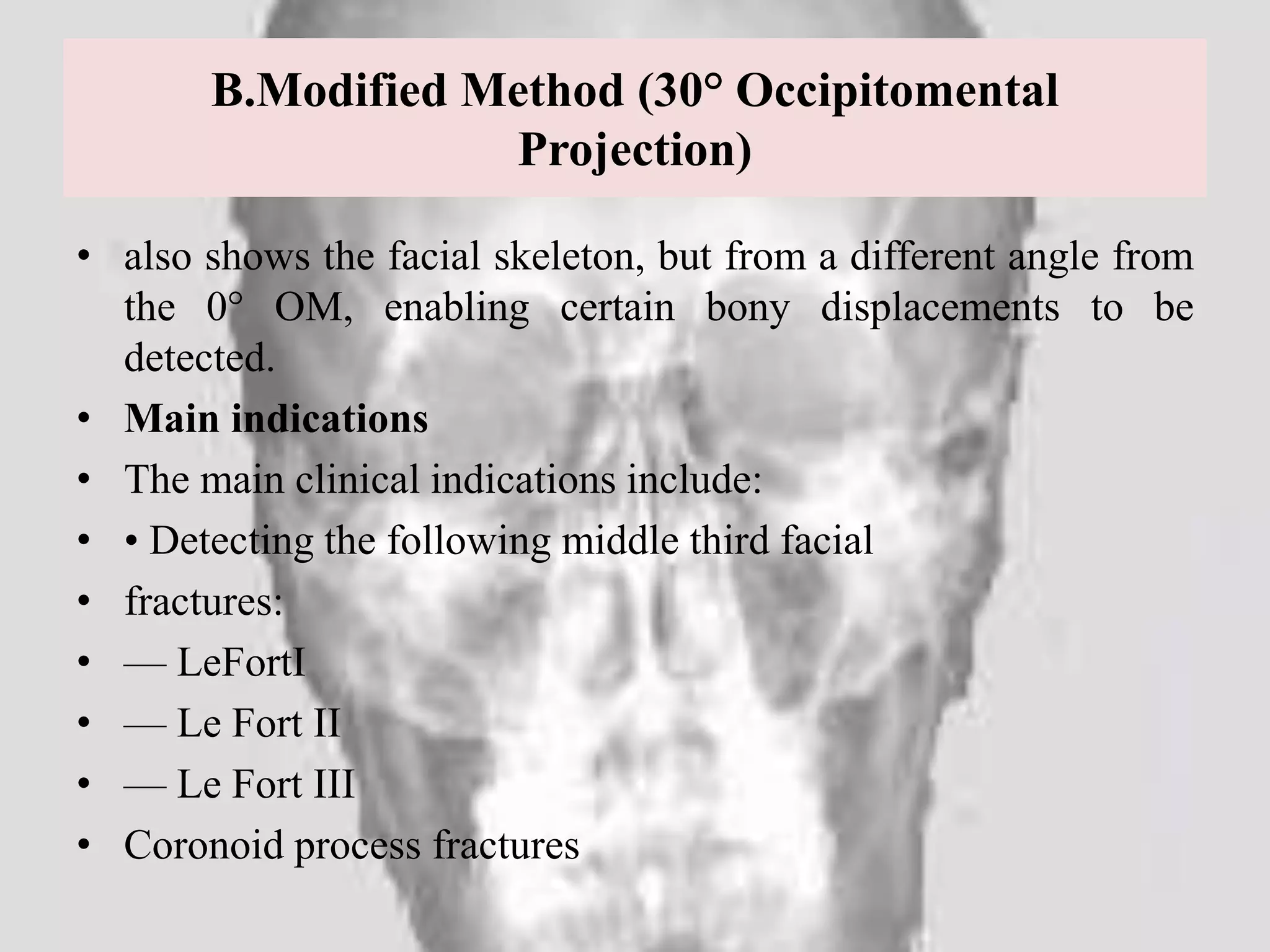 landmarks and interpretation in extraoral radiography | PPTX