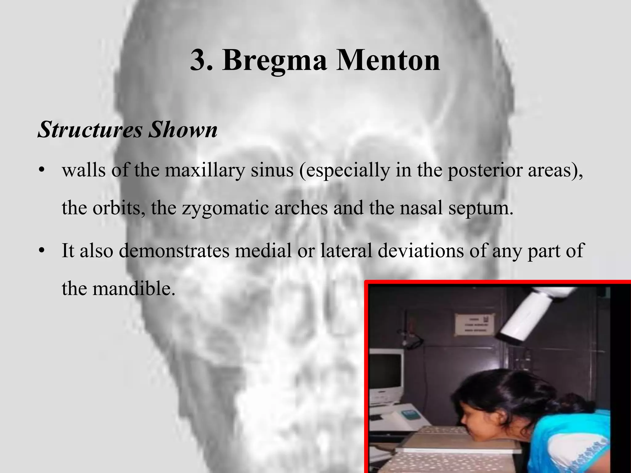landmarks and interpretation in extraoral radiography | PPTX