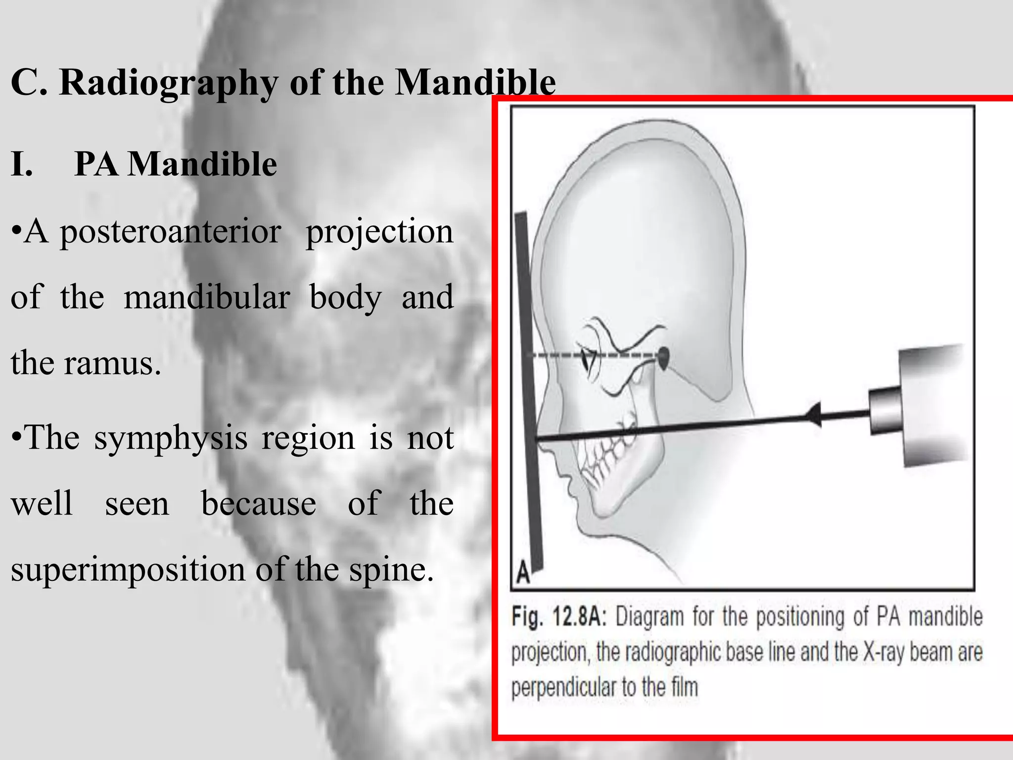 landmarks and interpretation in extraoral radiography | PPTX