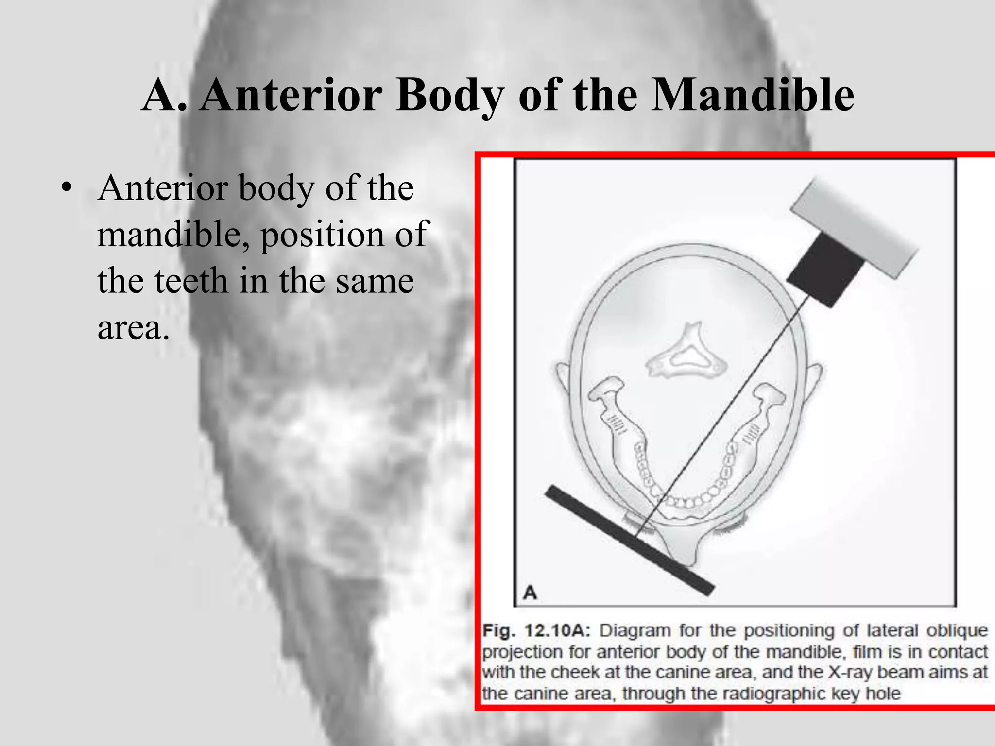 landmarks and interpretation in extraoral radiography | PPTX