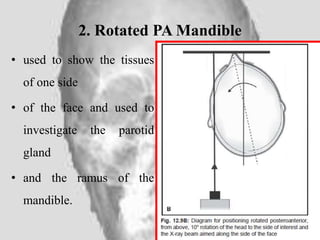 landmarks and interpretation in extraoral radiography | PPTX