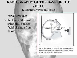 landmarks and interpretation in extraoral radiography | PPTX