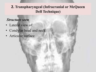 landmarks and interpretation in extraoral radiography | PPTX