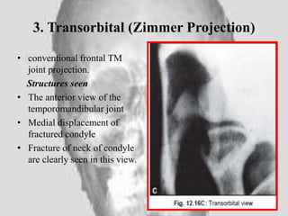 landmarks and interpretation in extraoral radiography | PPTX