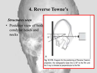 landmarks and interpretation in extraoral radiography | PPTX