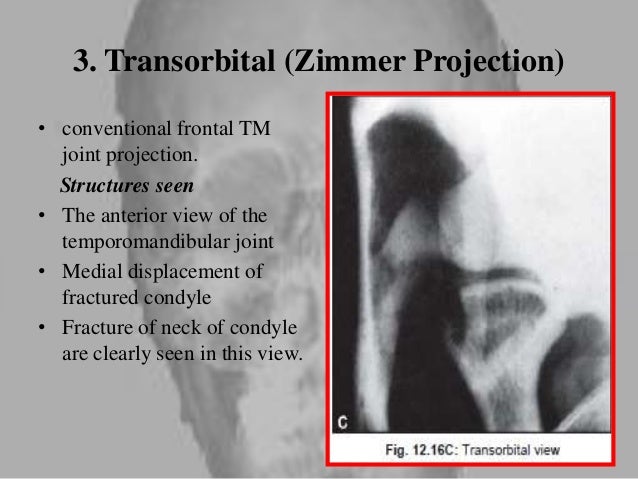 landmarks and interpretation in extraoral radiography