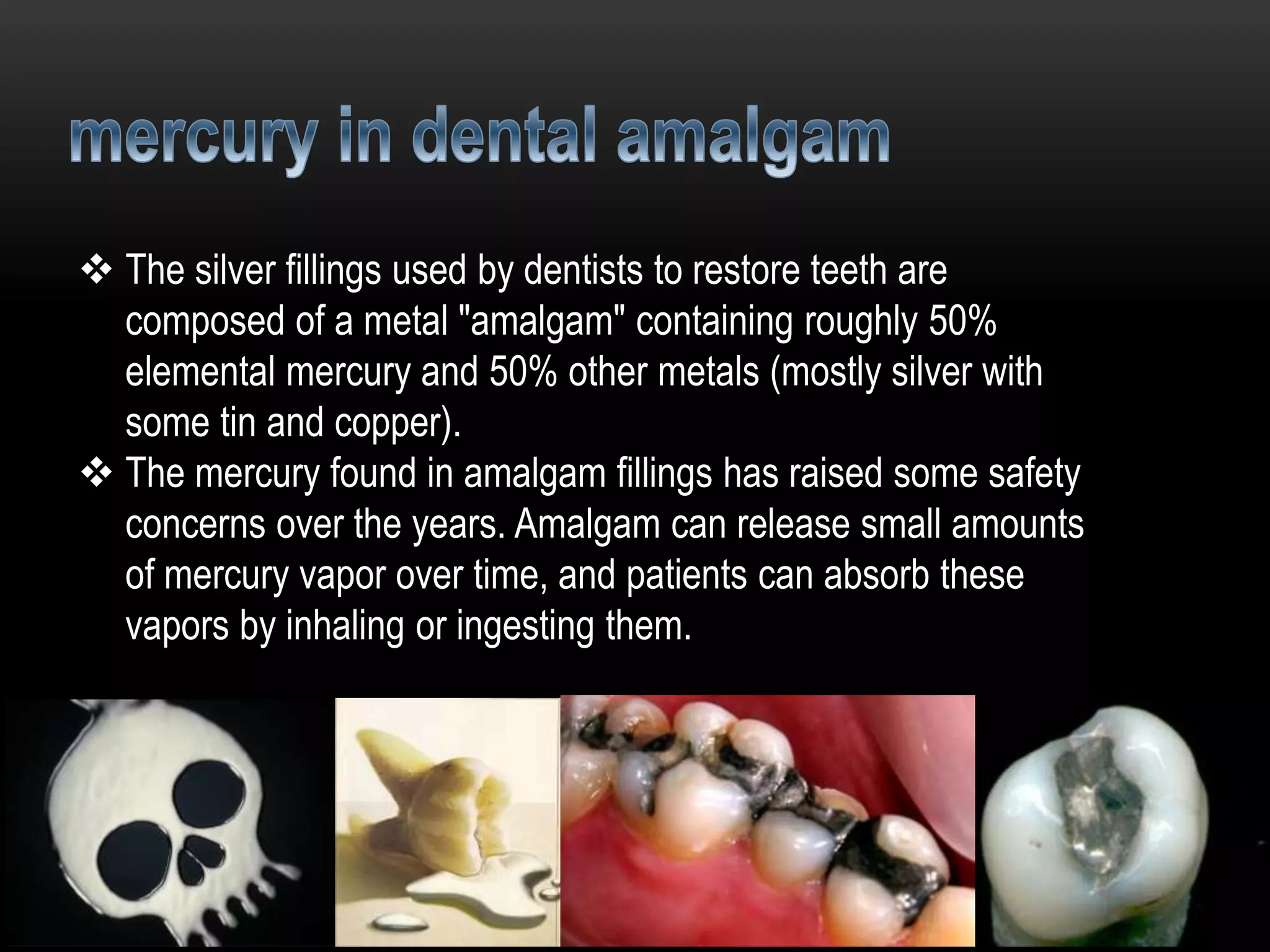 Mercury poisoning & dental amalgam | PPT