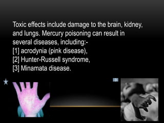Mercury poisoning & dental amalgam | PPTX