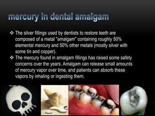 Mercury poisoning & dental amalgam | PPTX