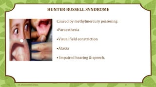 MERCURY TOXICITY | PPTX