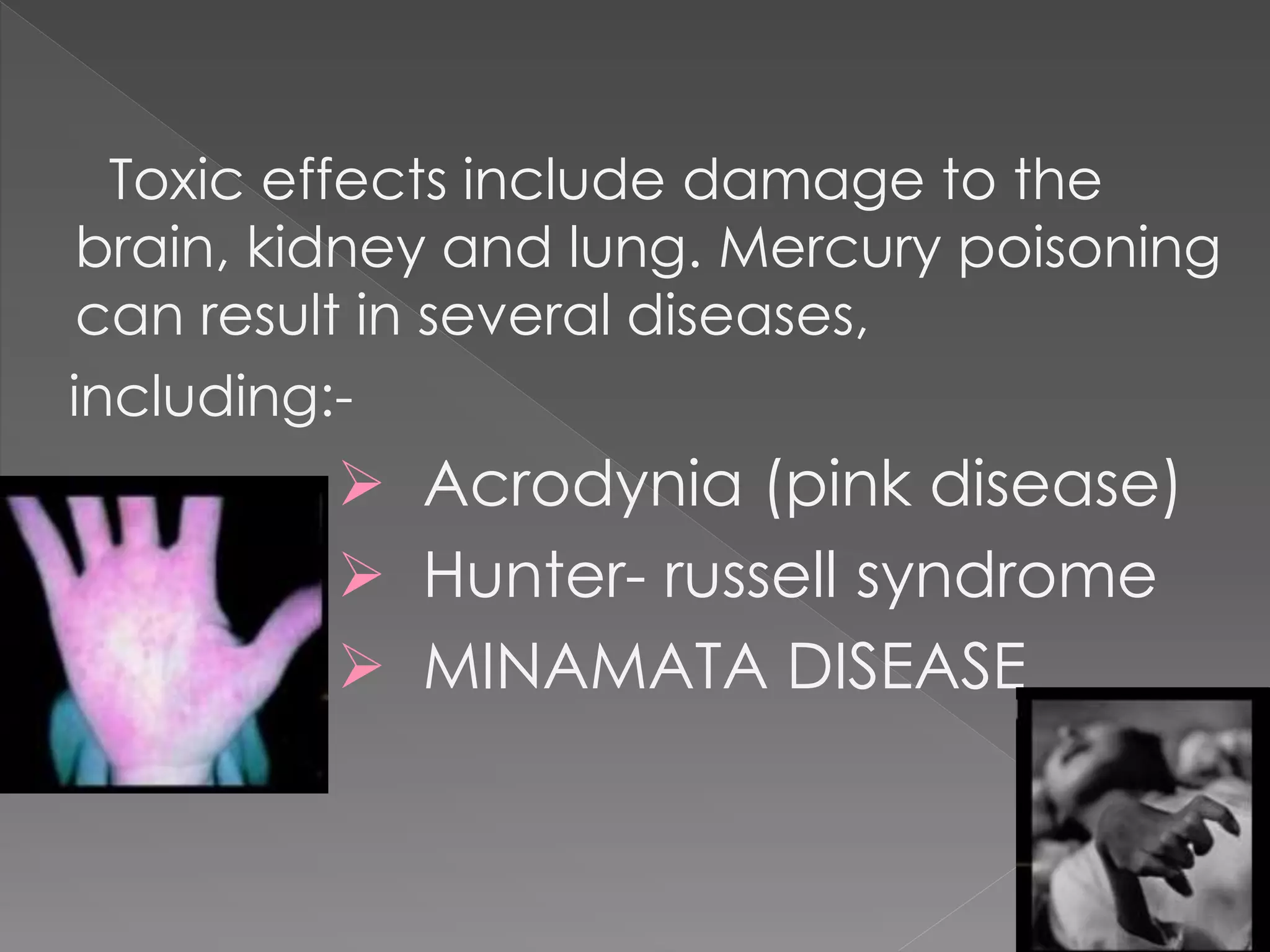 Mercury toxicity & hygiene | PPTX